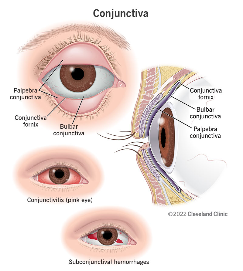 Congiuntiva Anatomia Funzione E Condizioni Comuni SFOMC Congiuntiva Anatomia Funzione E Condizioni Comuni SFOMC