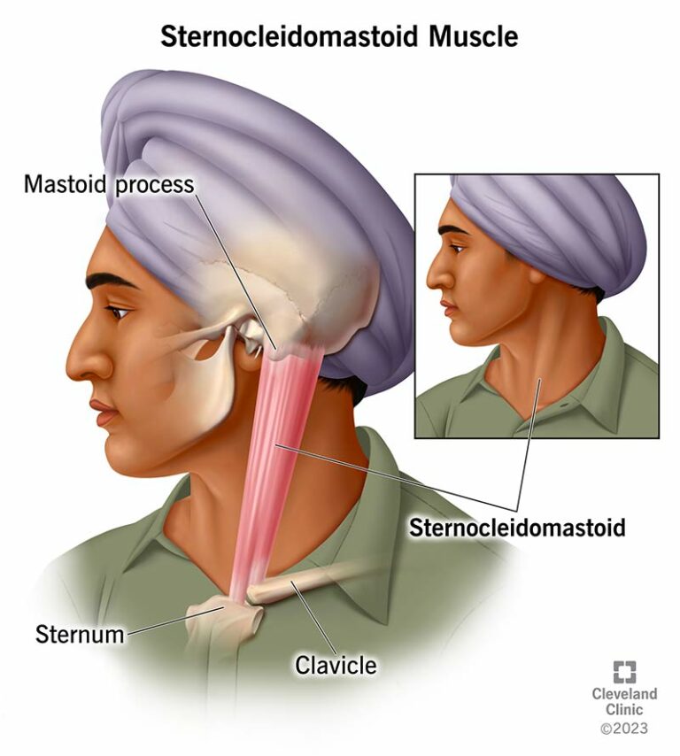 Cos'è Lo Sternocleidomastoideo (muscolo SCM)? - SFOMC