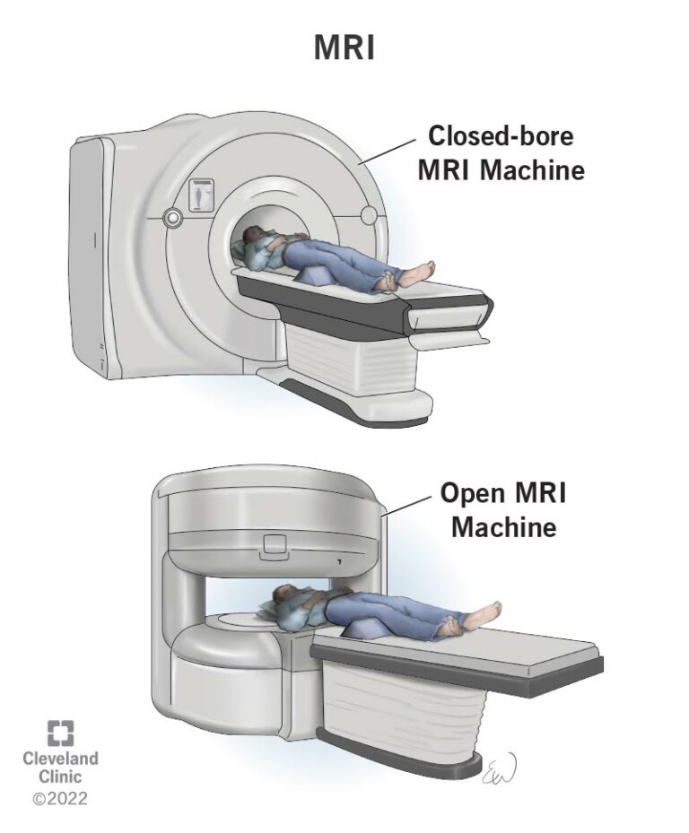 MRI (risonanza Magnetica): Cos'è, Tipi E Risultati - SFOMC